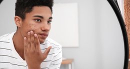 Causas e tratamentos para manchas escuras na pele | L'Oréal Paris