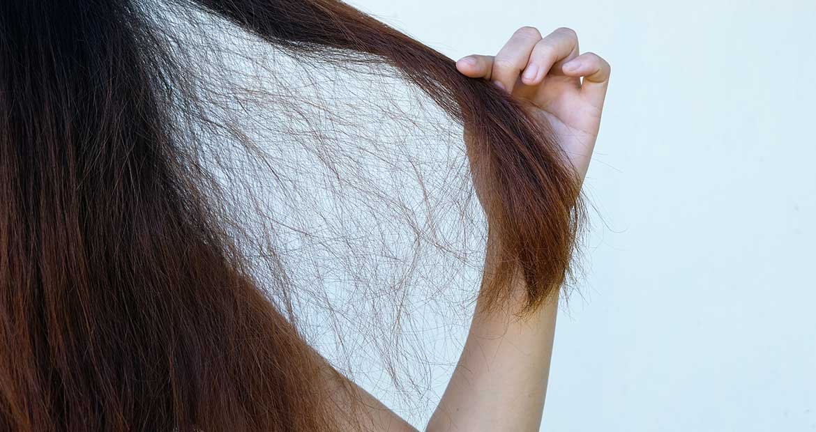 Cabelo ressecado? Conheça 5 hábitos que podem ressecar os fios | L ...